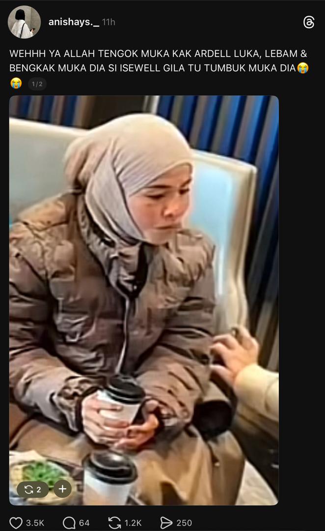 Netizen Sebak, Dakwa Foto Tular Ardell Nampak Kesan Lebam Di Bahagian ...